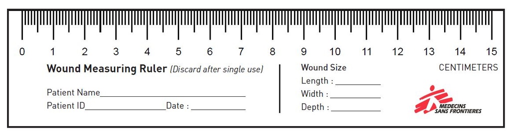 WOUND MEASURE RULER, paper sheet, English, A4, recto | Unicat